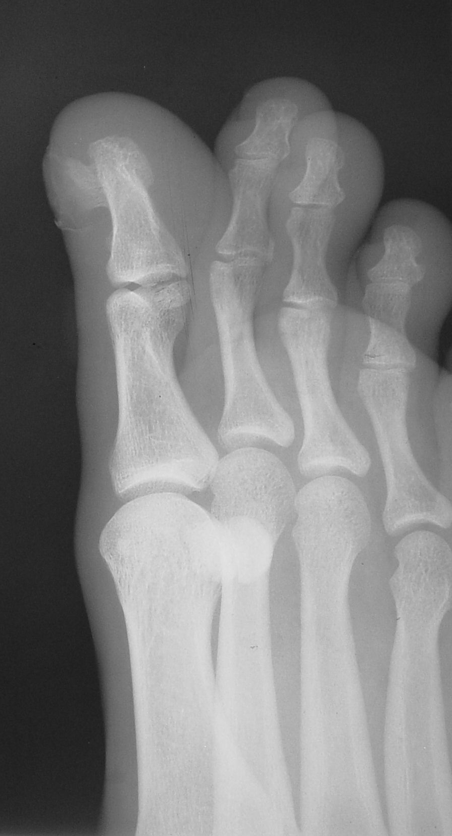 Ucsd Musculoskeletal Radiology